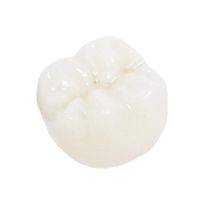 Crowns & Bridges | MediMatch Dental Laboratory