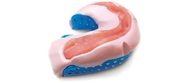 Copy Technique for Complete Dentures | MediMatch Dental Laboratory