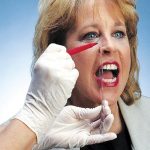 Facebow Records Using the Denar ® Slidematic System | MediMatch Dental ...