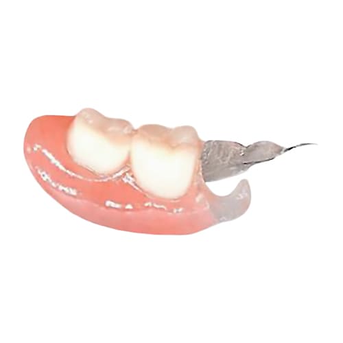 Telescopic Denture Clinical Guide | MediMatch Dental Laboratory