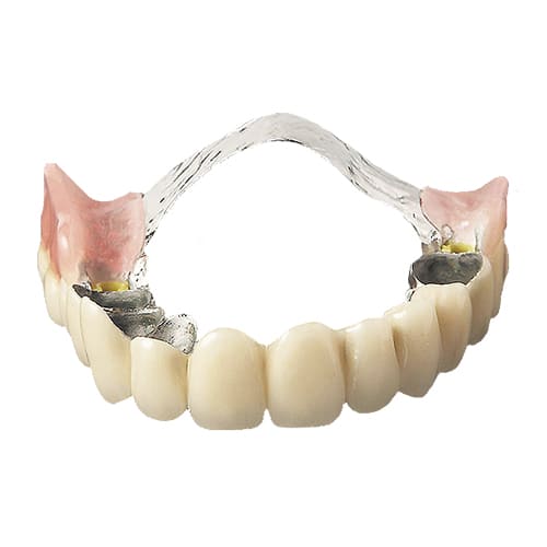 Telescopic Denture From Start to Finish | MediMatch Dental Laboratory