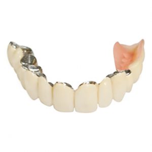 Copy Technique for Complete Dentures | MediMatch Dental Laboratory