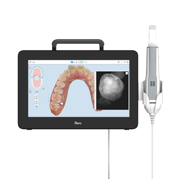 iTero Element 5D Plus Mobile | MediMatch Dental Laboratory