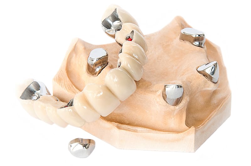 MediMatch Dental Laboratory | Digital Dental Lab London UK