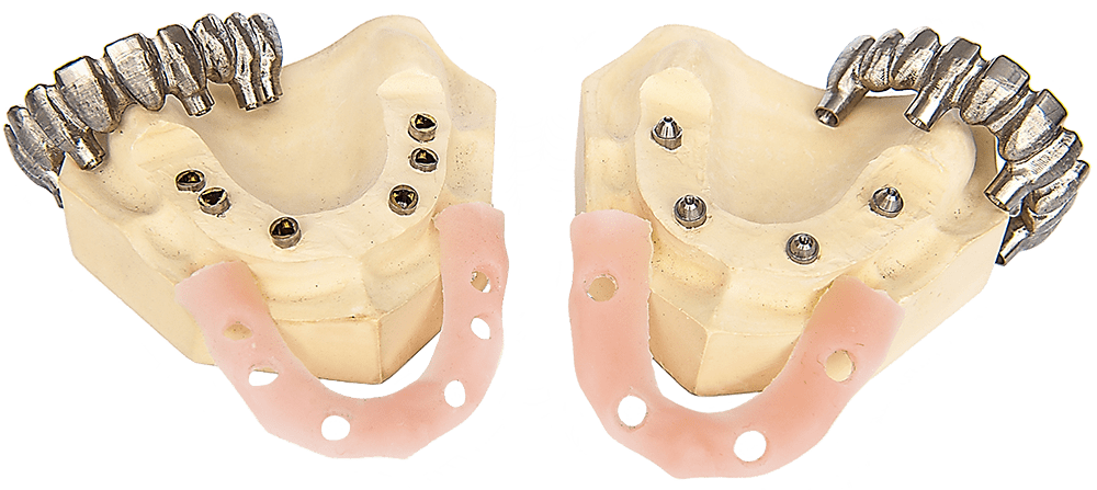 MediMatch Dental Laboratory | Digital Dental Lab Dublin Ireland
