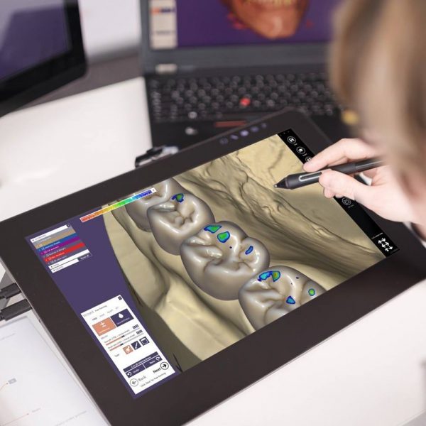 Exocad Design Course | MediMatch Dental Laboratory