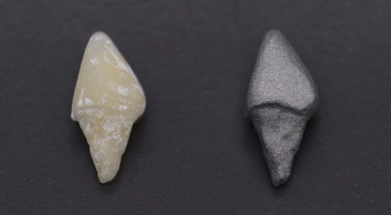 The making of a Post & Core by combining traditional and digital ...