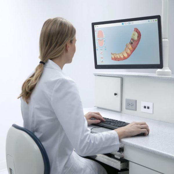 iTero Element Flex Brand new demo | MediMatch Dental Laboratory