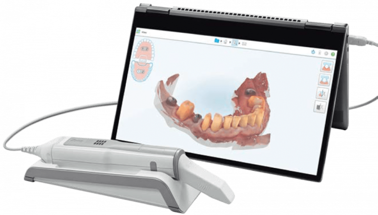 iTero Element Flex Brand new demo | MediMatch Dental Laboratory