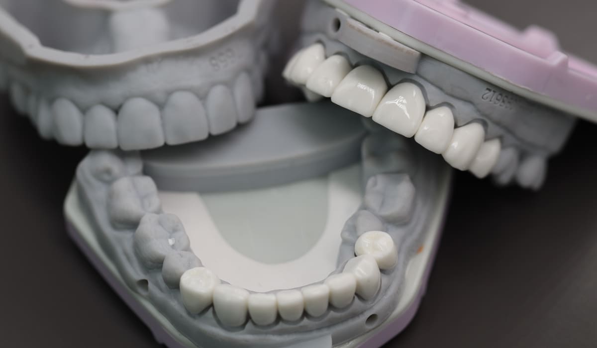 PMMA restorations for large upper and lower case | MediMatch Dental ...