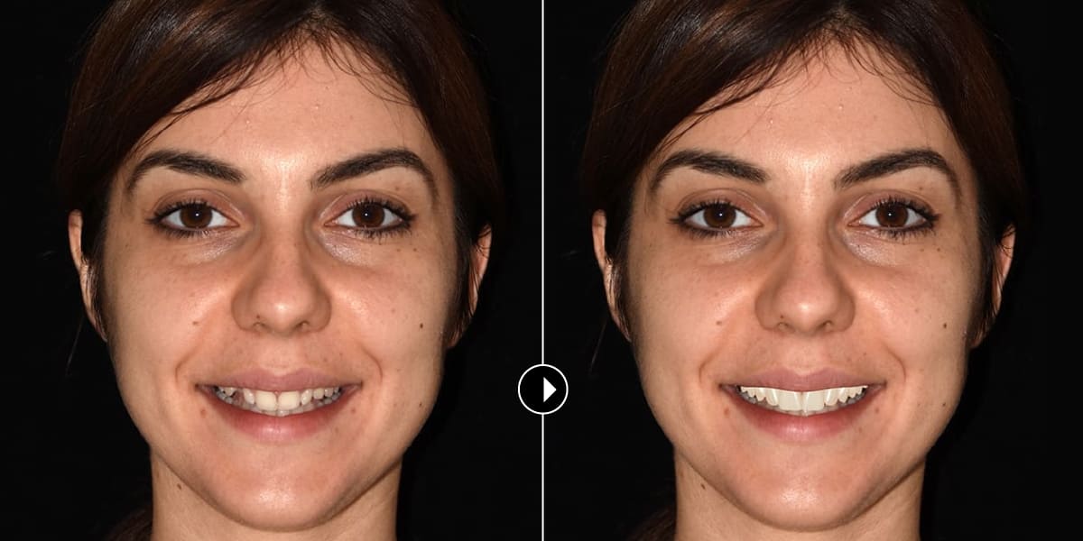 Smile Creator Stand-alone Module | MediMatch Dental Laboratory