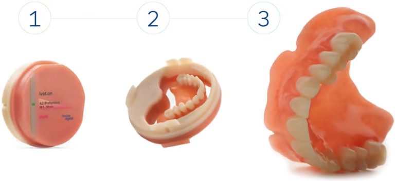 Ivotion | MediMatch Dental Laboratory
