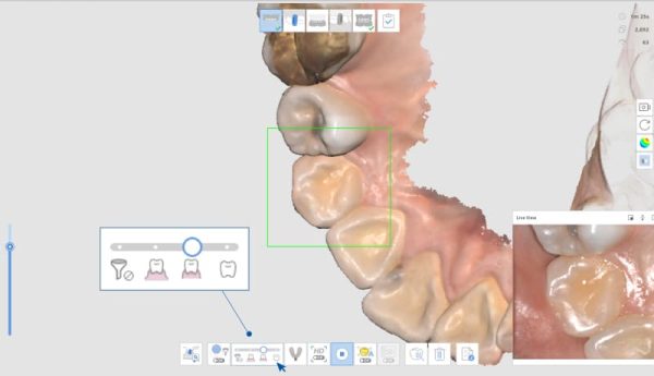 Medit Scanning Course | MediMatch Dental Laboratory