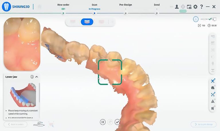 MetiSmile 3D Face Scanner Brand new demo | MediMatch Dental Laboratory