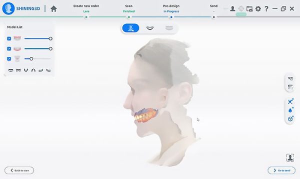 MetiSmile 3D Face Scanner Brand new demo | MediMatch Dental Laboratory