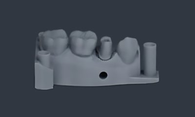 Phrozen Sonic XL 4K Plus 3D Printer | MediMatch Dental Laboratory