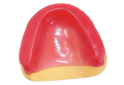 Recording a Bite Registration for the Edentulous Patient | MediMatch ...