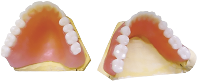Copy Technique for Complete Dentures | MediMatch Dental Laboratory