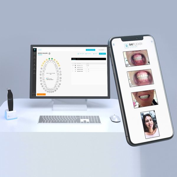 Rayplicker Cobra | MediMatch Dental Laboratory