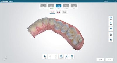 Fussen S6000 | MediMatch Dental Laboratory