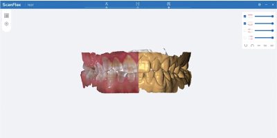 Fussen S6500 wired IOS | MediMatch Dental Laboratory