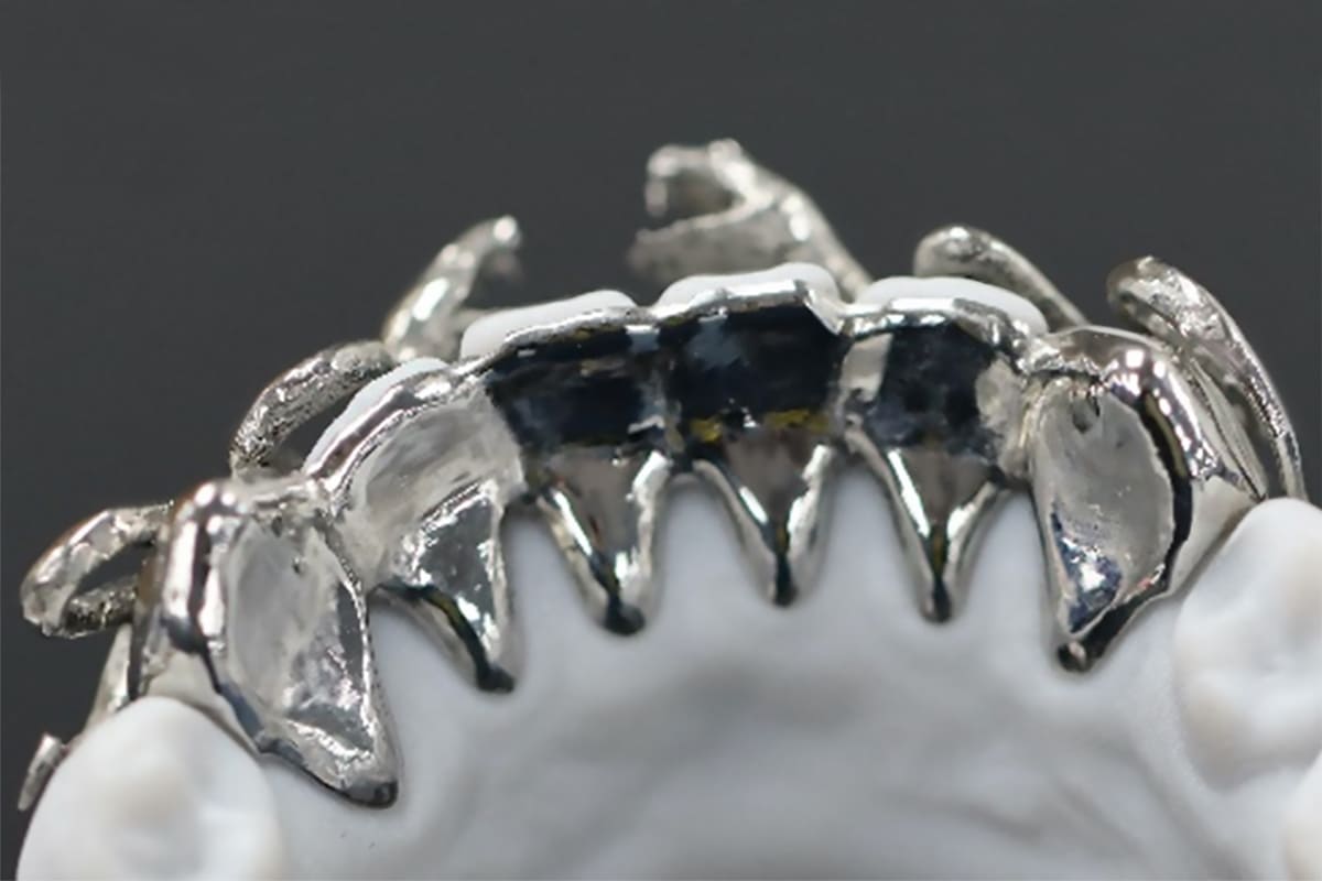 Dental Grillz | MediMatch Dental Laboratory