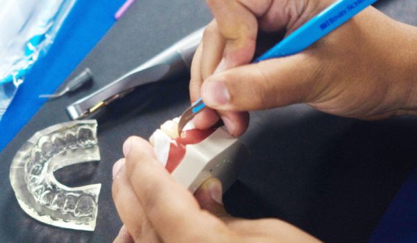 GC Composite Injection Protocol | MediMatch Dental Laboratory