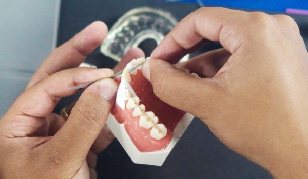 GC Composite Injection Protocol | MediMatch Dental Laboratory