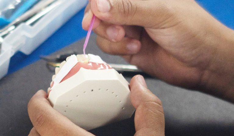 GC Composite Injection Protocol | MediMatch Dental Laboratory