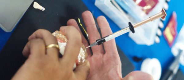 GC Composite Injection Protocol | MediMatch Dental Laboratory