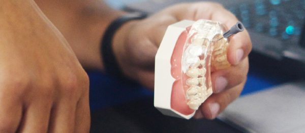 GC Composite Injection Protocol | MediMatch Dental Laboratory