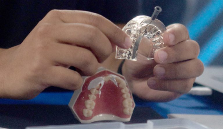 GC Composite Injection Protocol | MediMatch Dental Laboratory