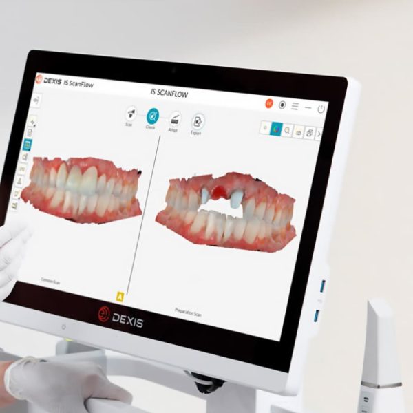 DEXIS IS 3800 | MediMatch Dental Laboratory