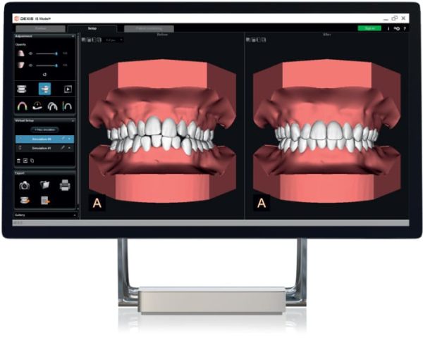 DEXIS IS 3800 | MediMatch Dental Laboratory