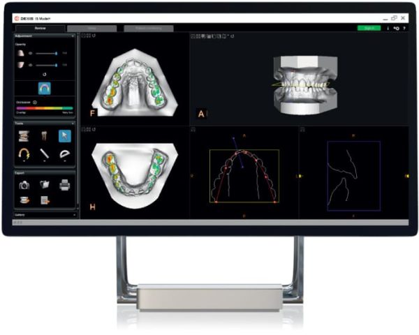 DEXIS IS 3800W | MediMatch Dental Laboratory