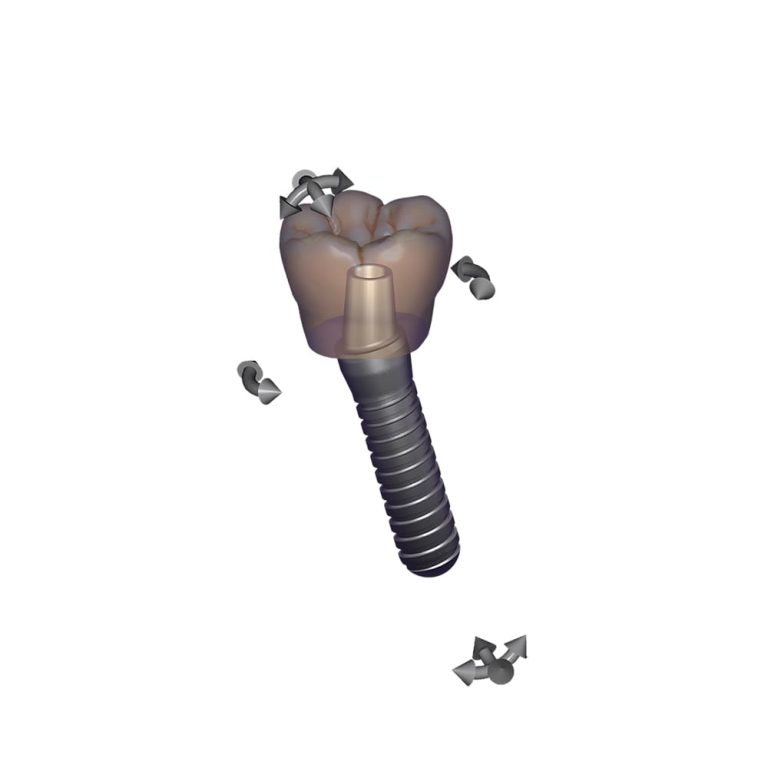 Exoplan for the Guide Creator | MediMatch Dental Laboratory