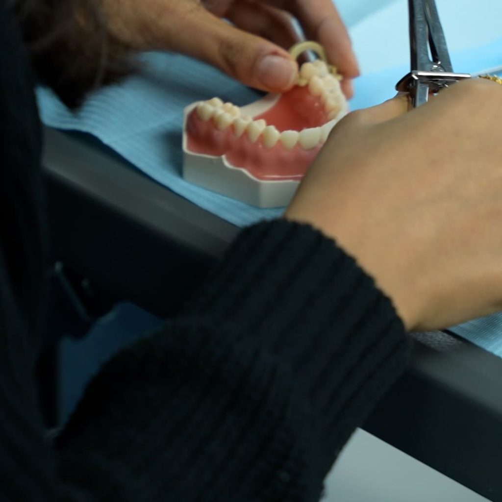 E.tchd | MediMatch Dental Laboratory