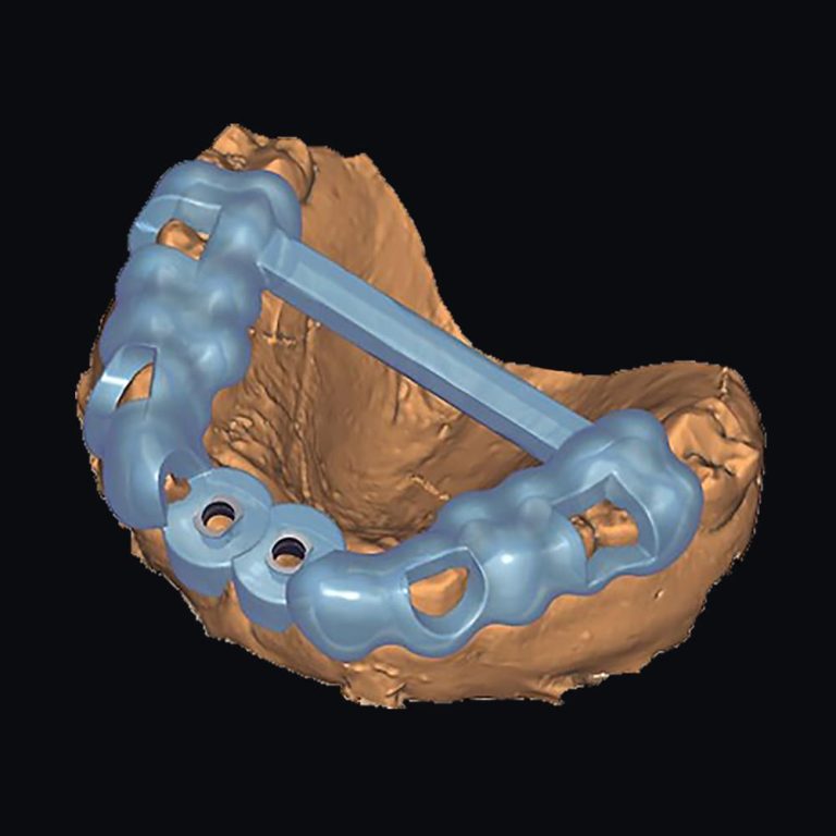 MediMatch Dental Laboratory | Digital Dental Lab London UK