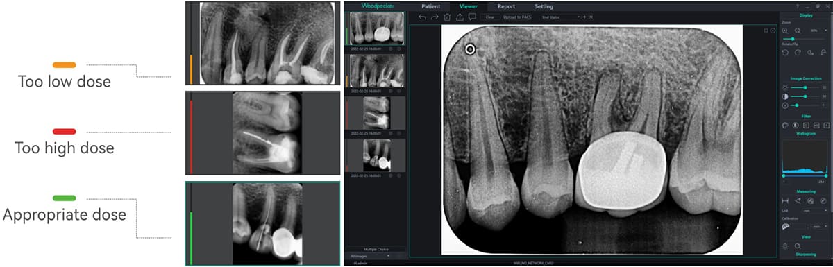 Woodpecker Free Scan Phosphor Plate Scanner | MediMatch Dental Laboratory